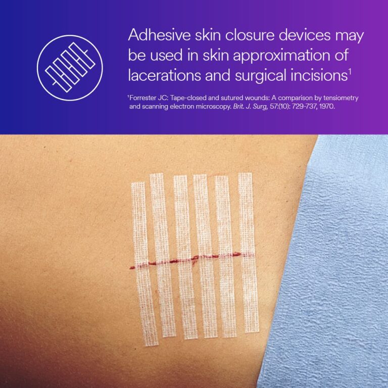 Steri‑Strip Reinforced Adhesive Skin Closures - First Line Medical